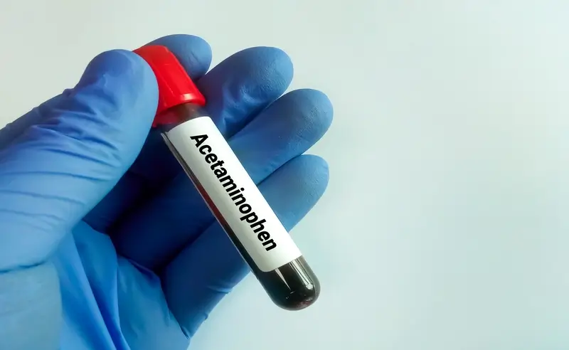 تحليل الأسيتامينوفين في الدم (Acetaminophen Test) | موقع طبيب