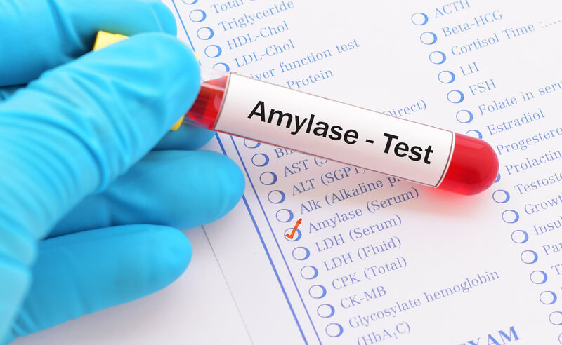 تحليل أنزيم الأميلاز (Amylase Enzyme Test) | موقع طبيب